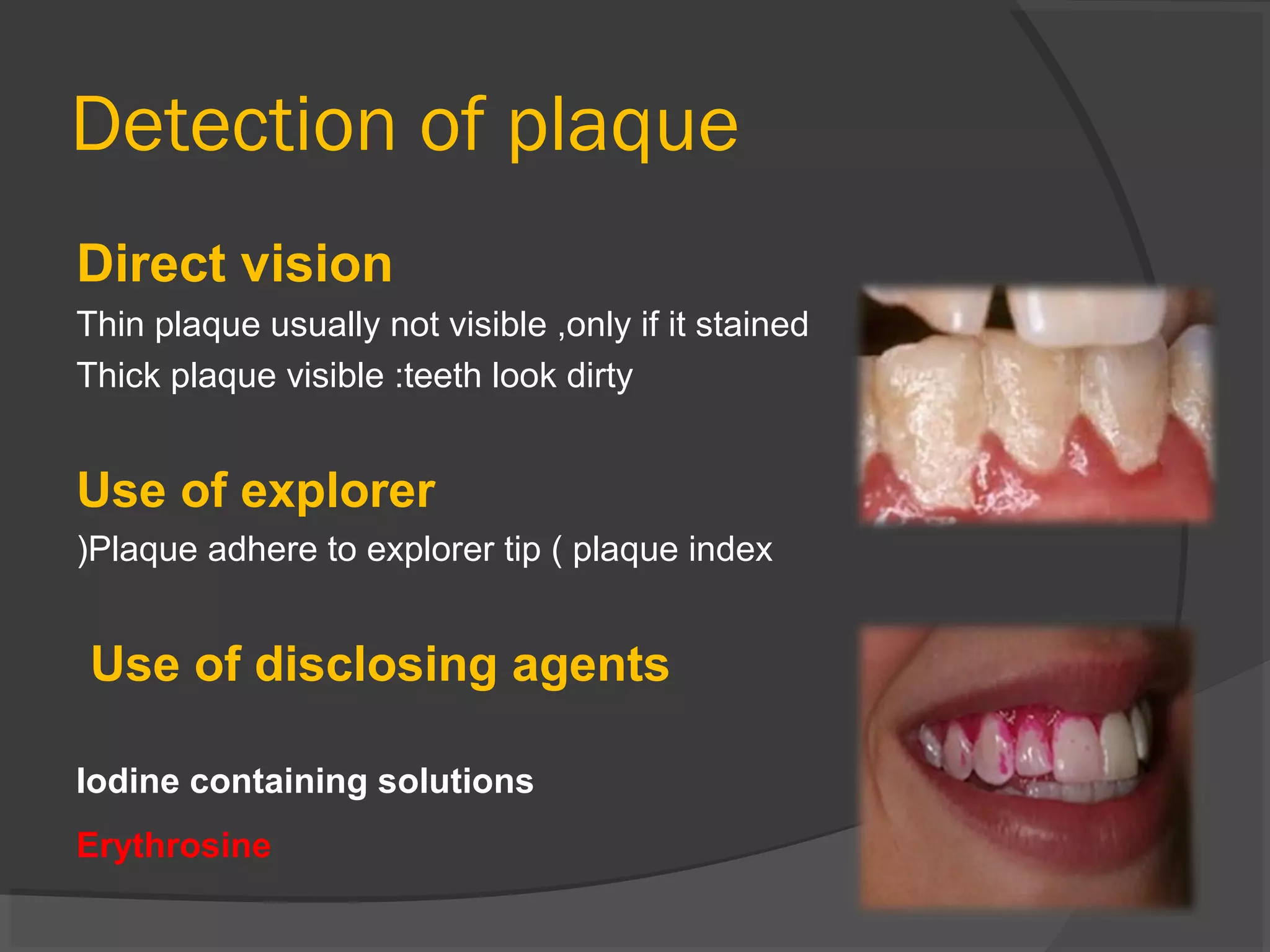 Periodontal examination and diagnosis | PPT