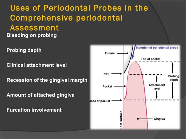Periodontal examination and diagnosis | PPT