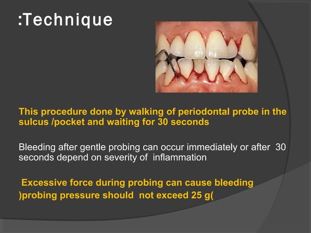 Periodontal examination and diagnosis | PPT