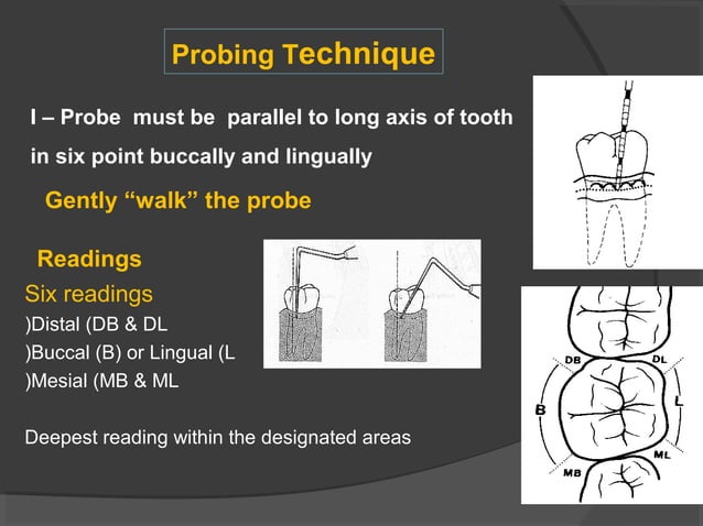 Periodontal examination and diagnosis | PPT