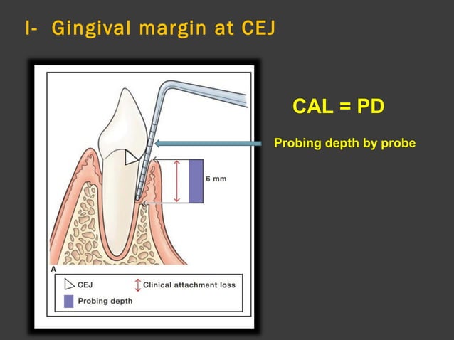 Periodontal examination and diagnosis | PPT