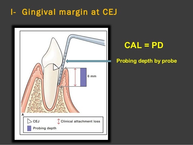 Periodontal examination and diagnosis