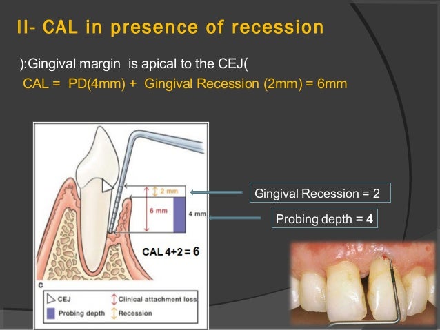 Periodontal examination and diagnosis