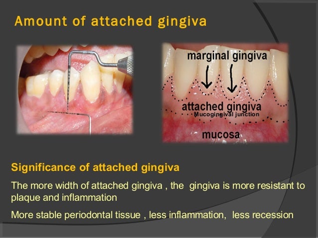 Periodontal examination and diagnosis