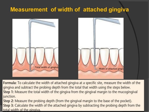 Periodontal examination and diagnosis
