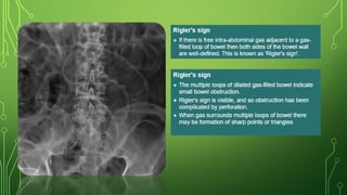 ABDOMINAL XRAYS REVIEW- EXTRALUMINAL GASES. | PDF