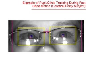 eyeblink-detection | PPTX