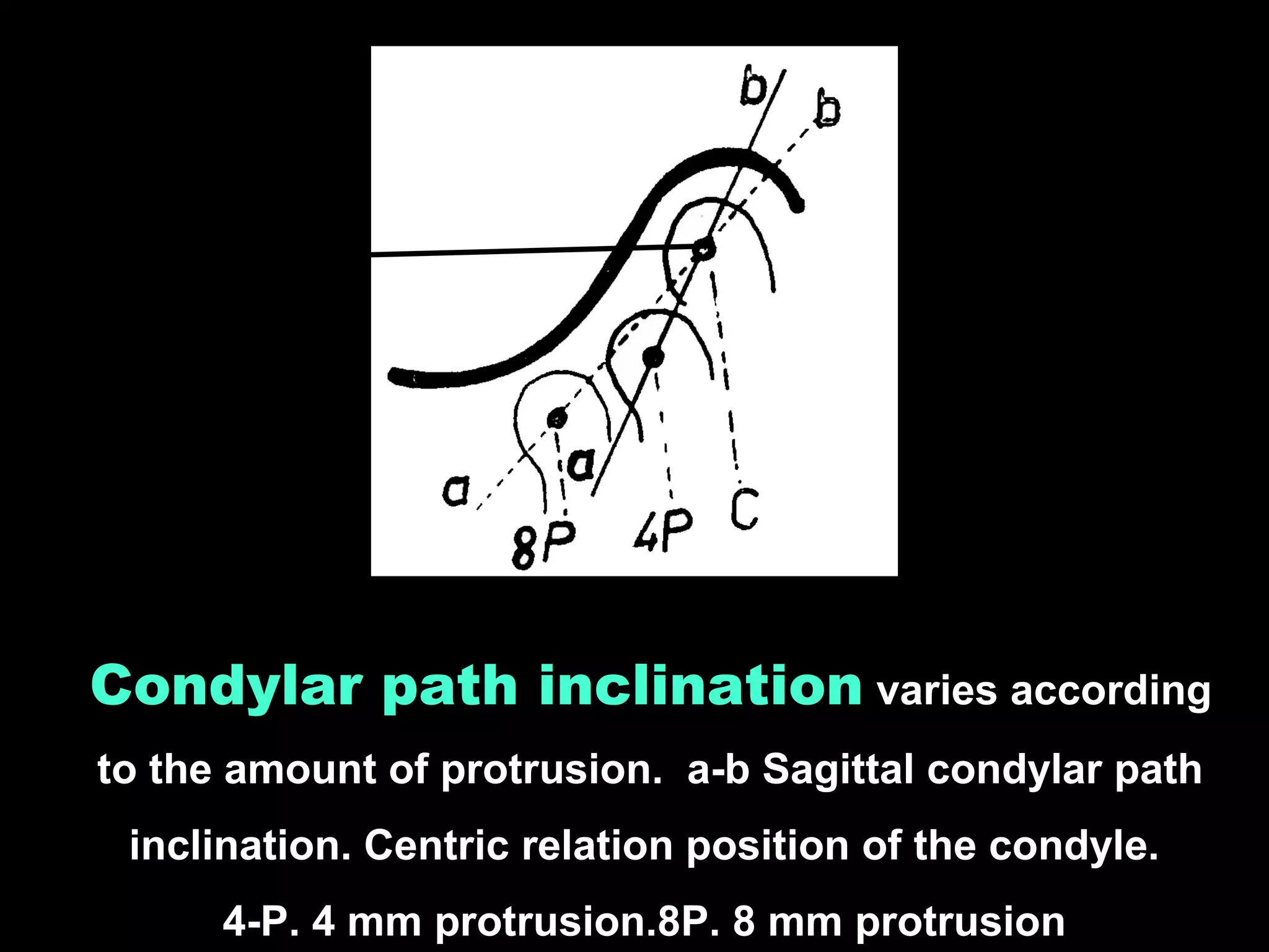 3- Factors affecting balanced occlusion final | PPT
