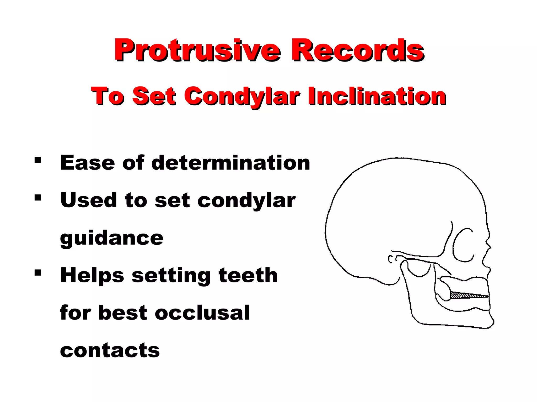 3- Factors affecting balanced occlusion final | PPT