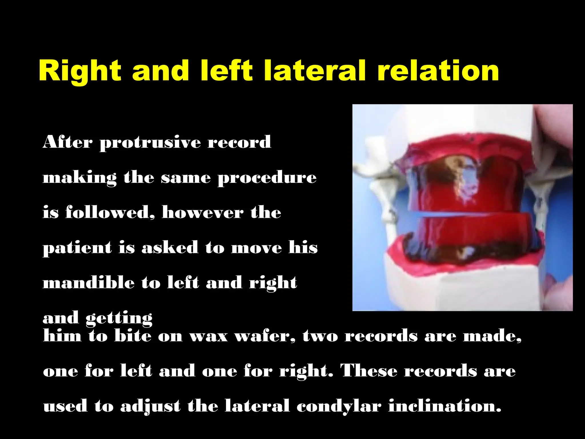 3- Factors affecting balanced occlusion final | PPT