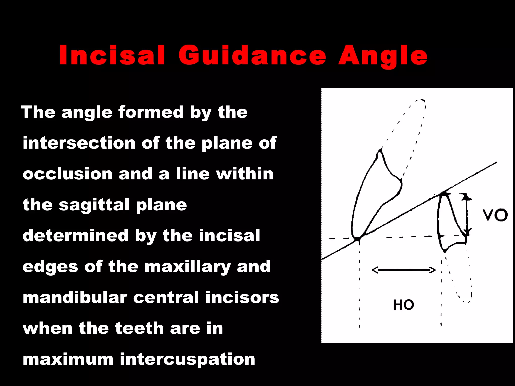 3- Factors affecting balanced occlusion final | PPT