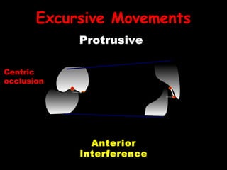 3- Factors affecting balanced occlusion final | PPT