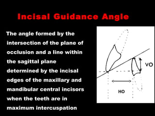 3- Factors affecting balanced occlusion final | PPT