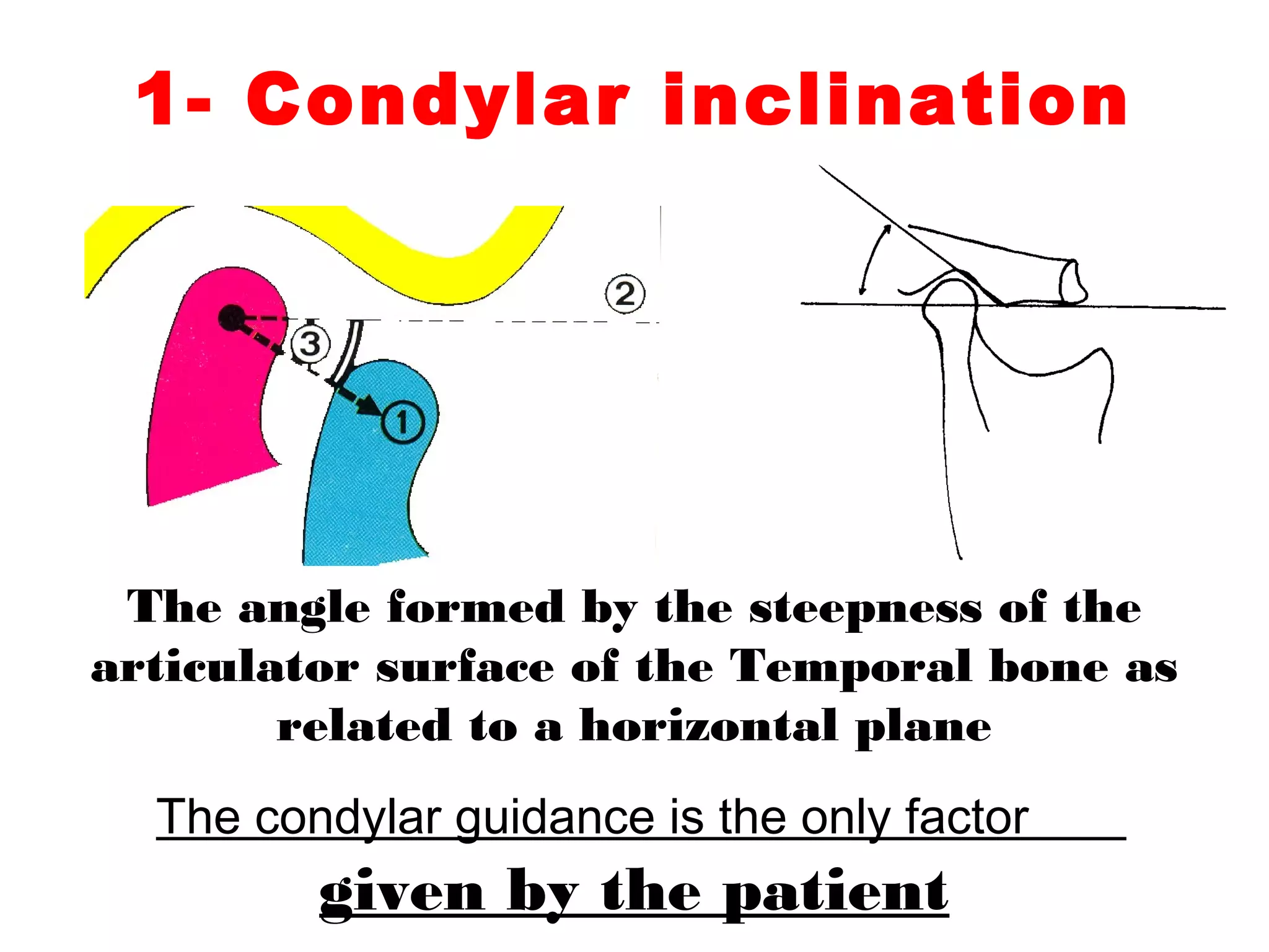3- Factors affecting balanced occlusion final | PPT