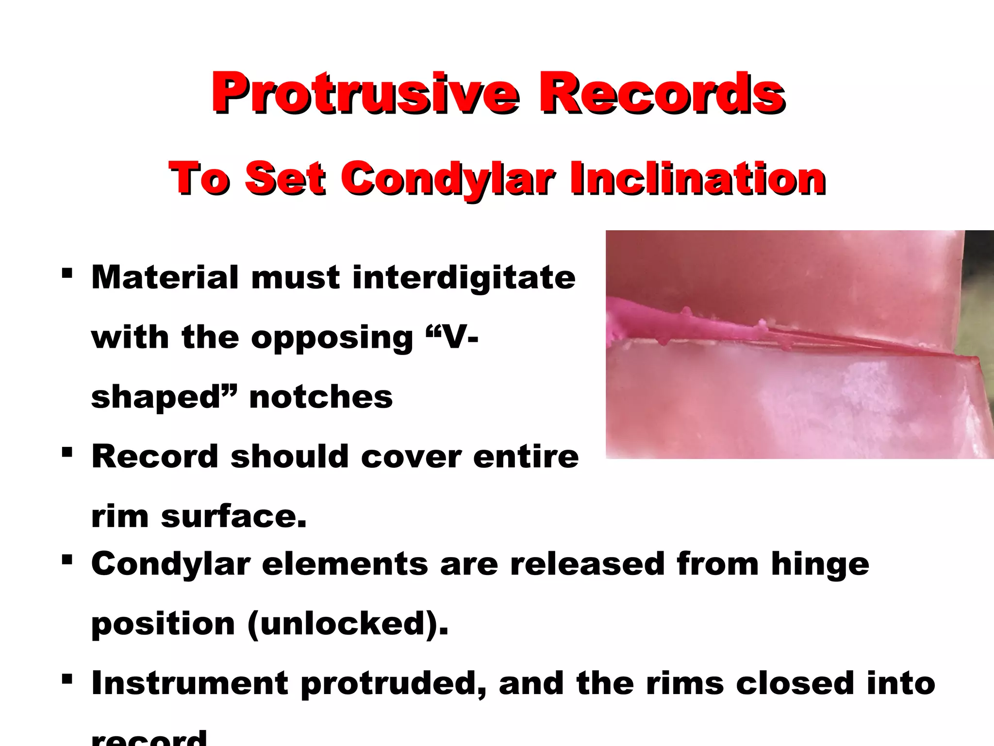 3- Factors affecting balanced occlusion final | PPT