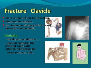 Fracture of Upper Limb | PPT