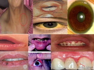 General Examination of GIT general medicine | PPT