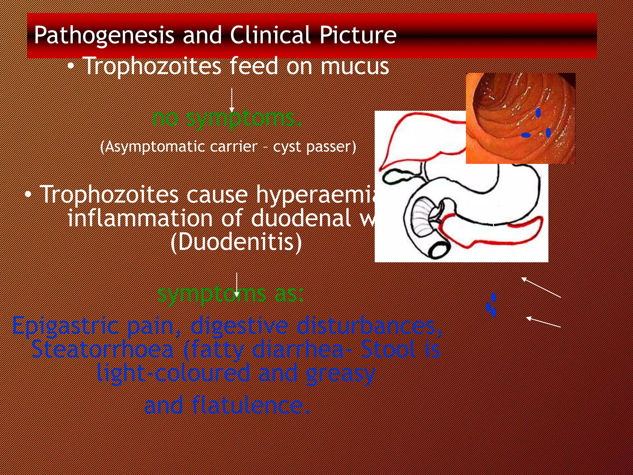 3-_Giardia_lamblia.ppt