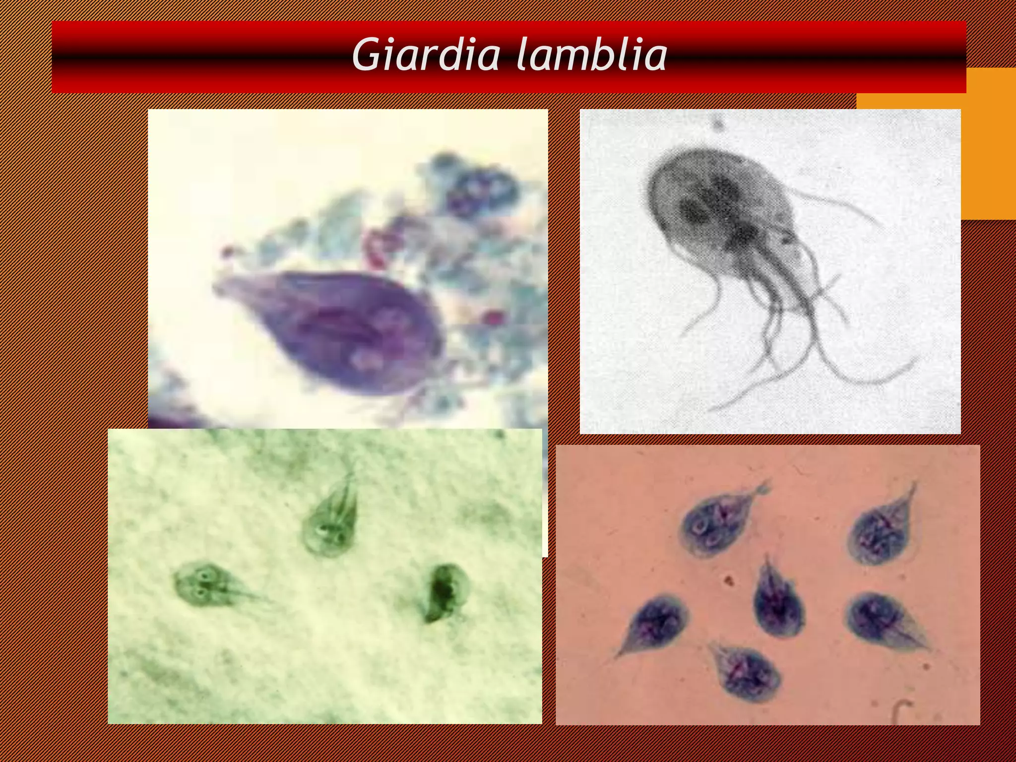 3-_Giardia_lamblia.ppt