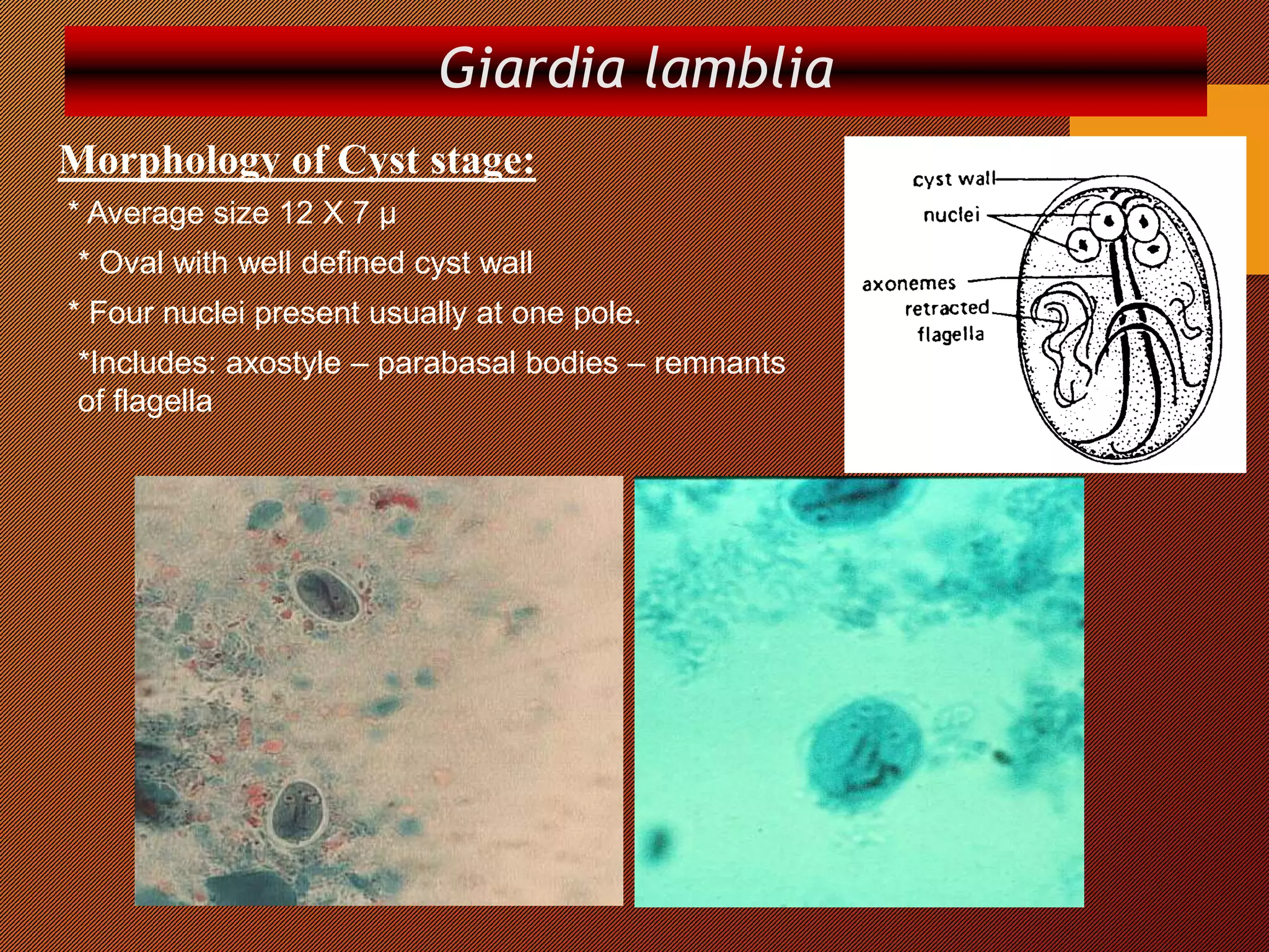 3-_Giardia_lamblia.ppt