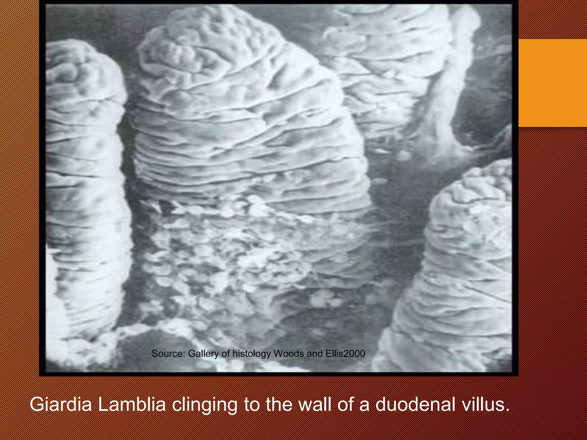 3-_Giardia_lamblia.ppt