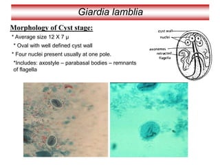 Giardia Lamblia Cyst Slide