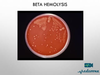 3-GPB Gram positive treptococcus bacteria | PPT