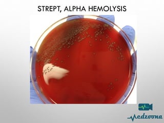 3-GPB Gram positive treptococcus bacteria | PPT