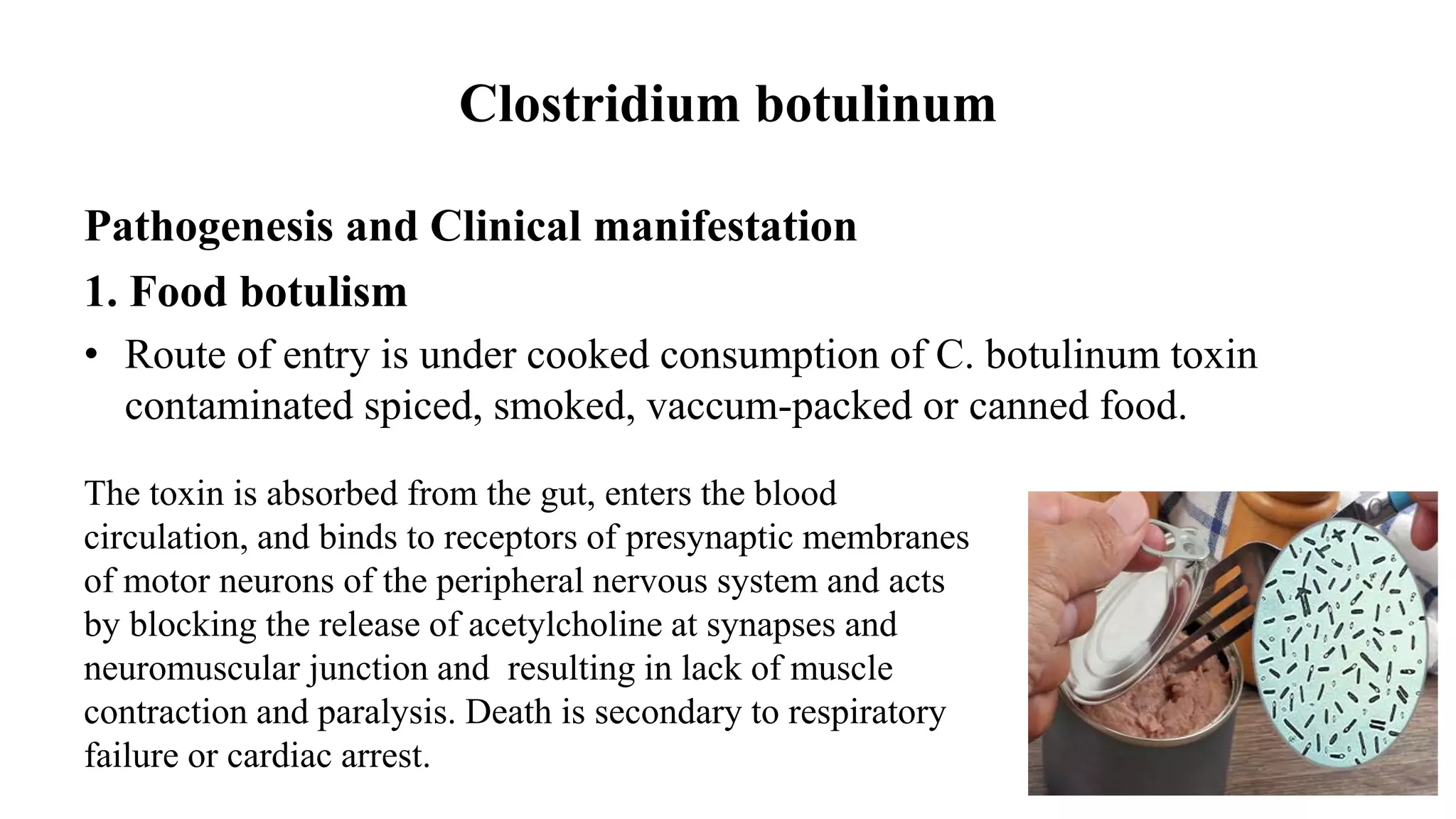 Gram Positive Spore Forming Rods | PPTX