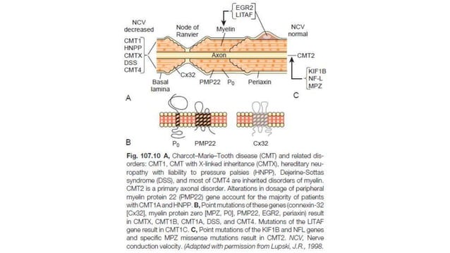 hereditary neuropathies | PPT