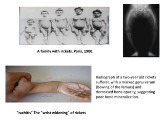 3-History and development of the science of nutrition (1).pptx