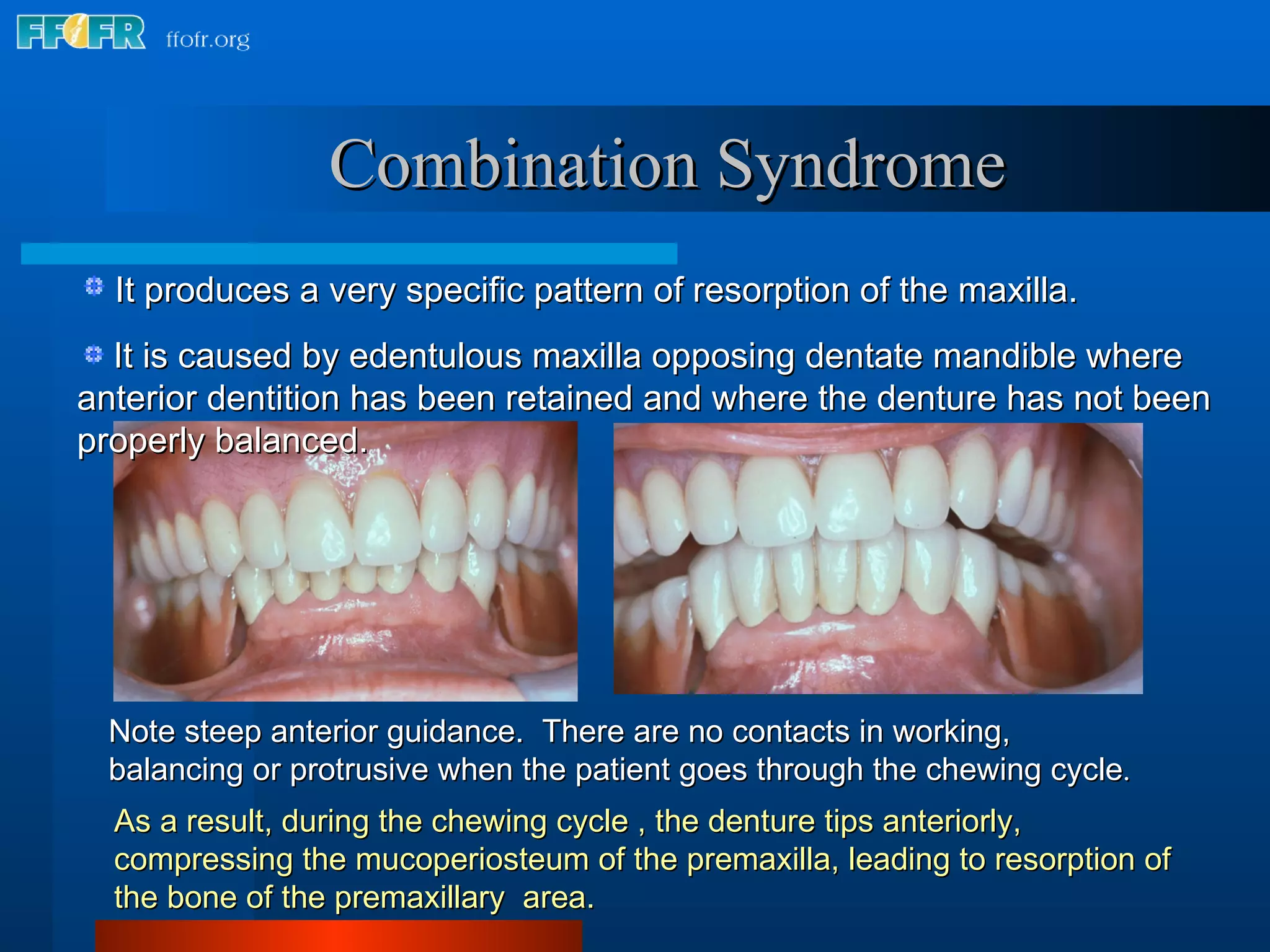 3.history and exam | PPT