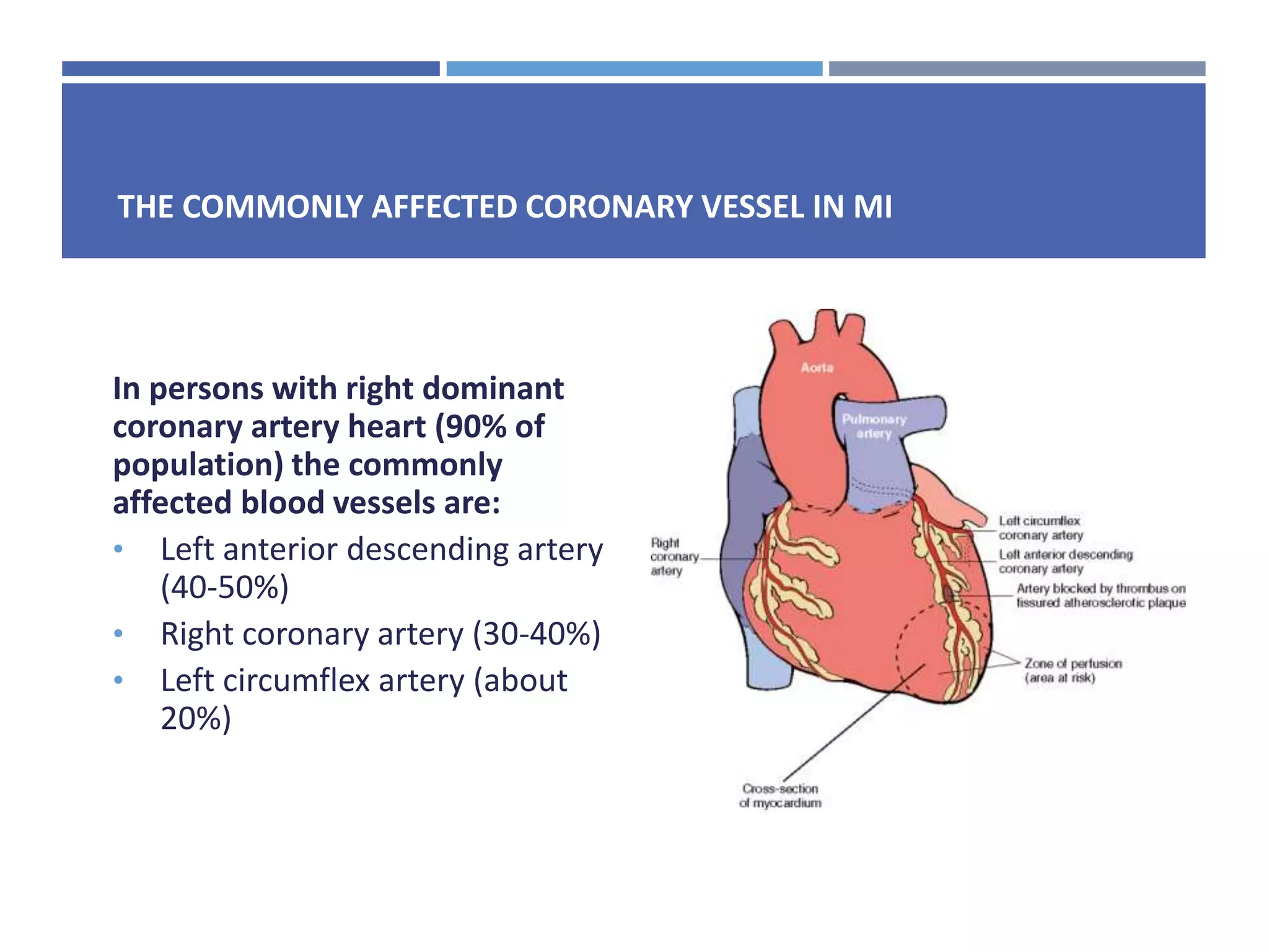 CVS pathology 3 - ischemic heart disease, angina and myocardial ...