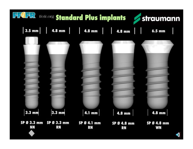 3.implant components and basic techniques3 | PDF
