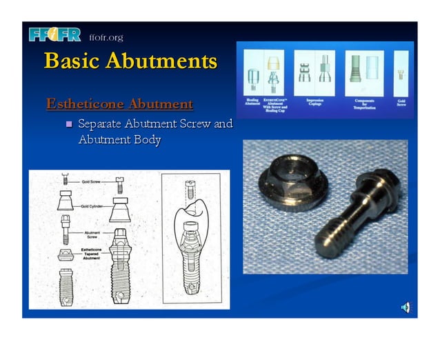 3.implant components and basic techniques3 | PDF