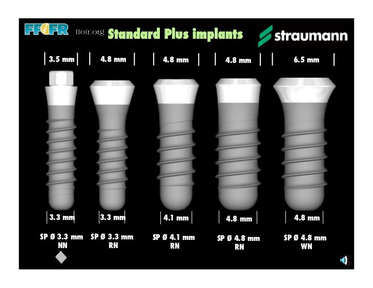 3.implant components and basic techniques3
