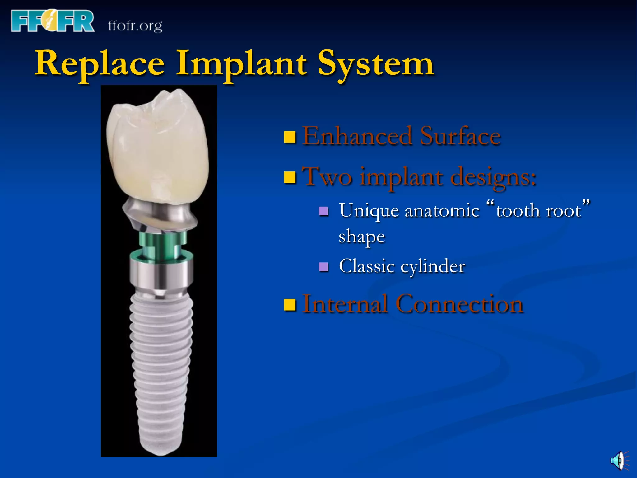 3.implant components and basic techniques3 | PDF