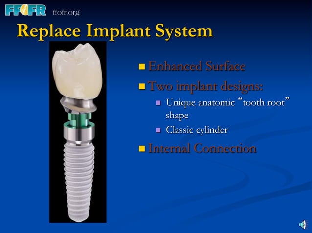 3.implant components and basic techniques3 | PPT