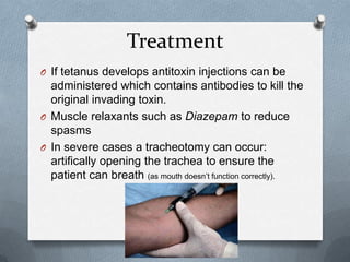 3 infectious and non-infectious diseases ppt | PPTX