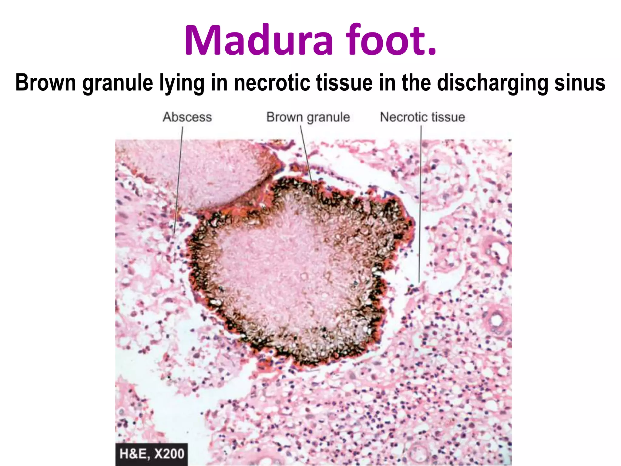 INFECTIOUS DISEASE (Diseases caused by bacteria, spirochaetes ...