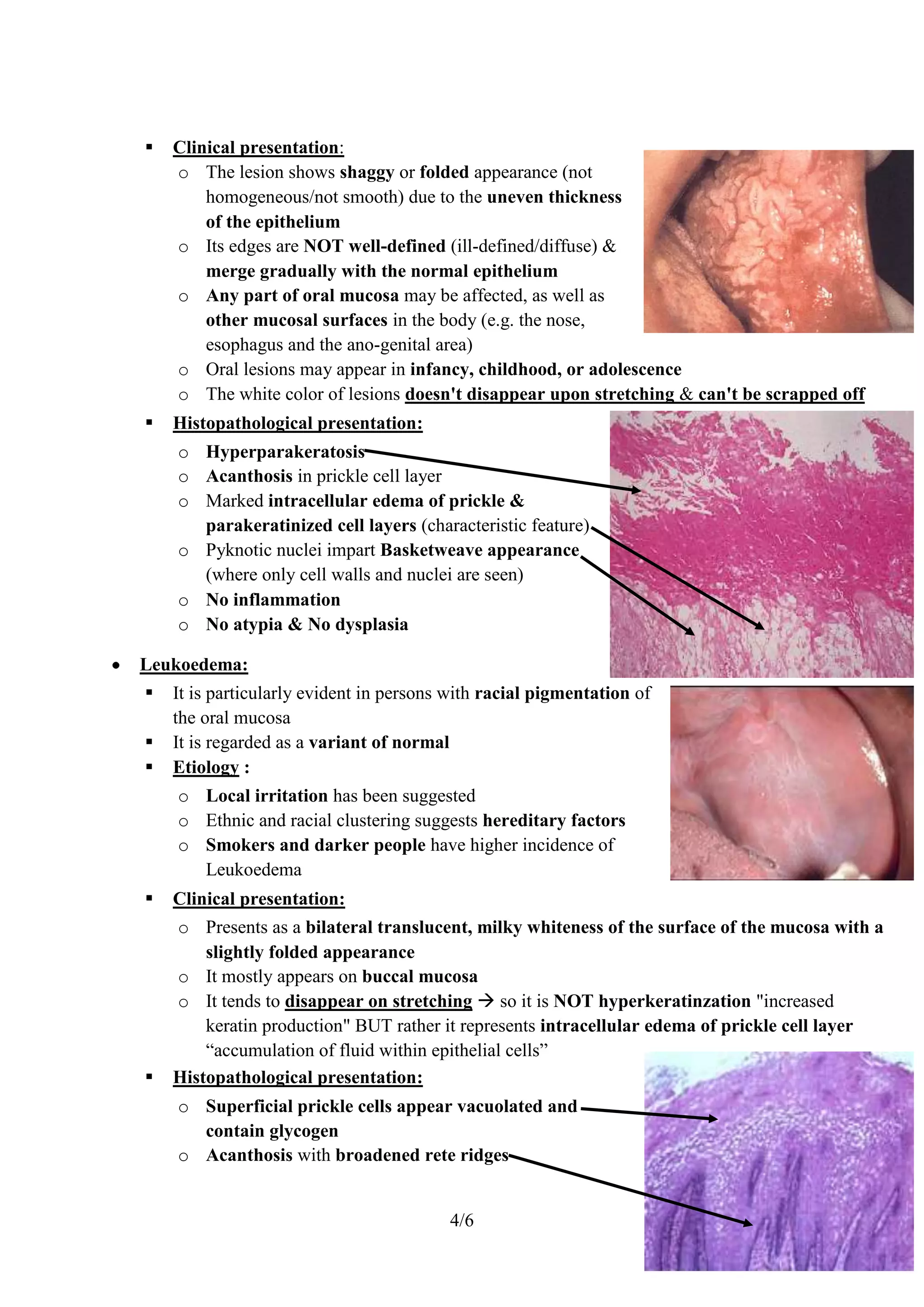 3 keratoses and related disorders of oral mucosa i | DOCX