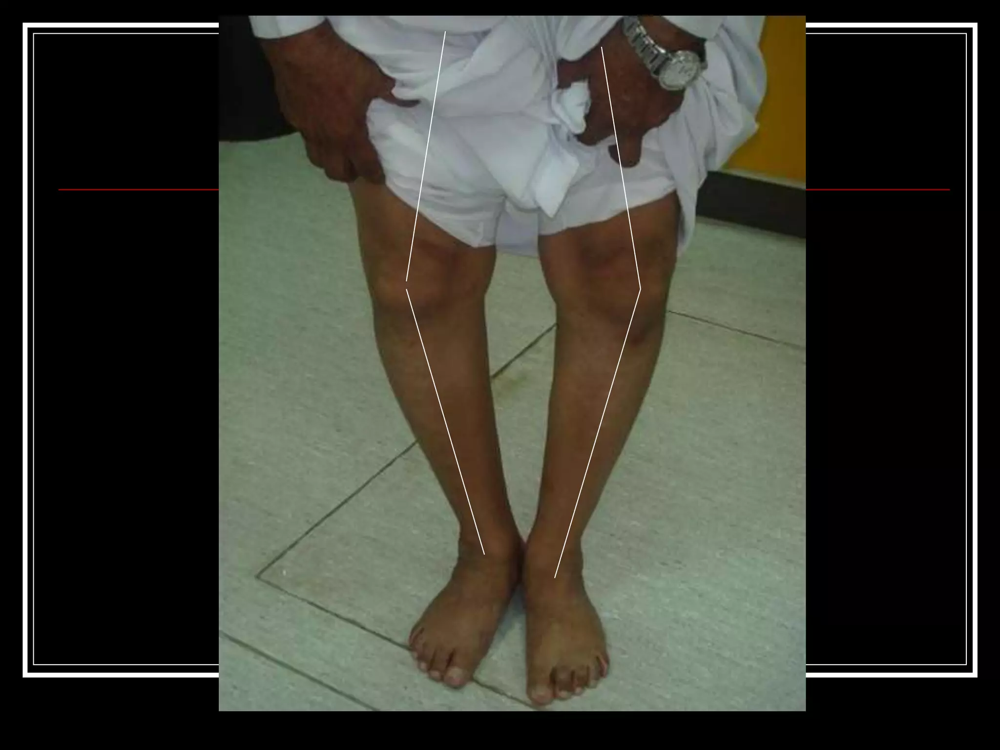 3-Knee Examination.ppt | Free Download