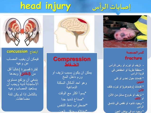 loss of consciousness -فقدان الوعى | PPT