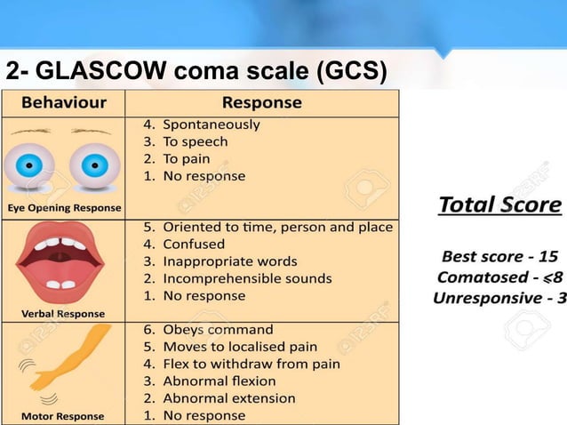 loss of consciousness -فقدان الوعى | PPT
