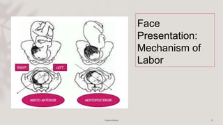 Face Presentations And Positions