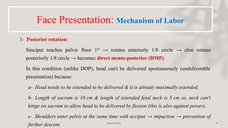 Face Presentation Mentum Posterior