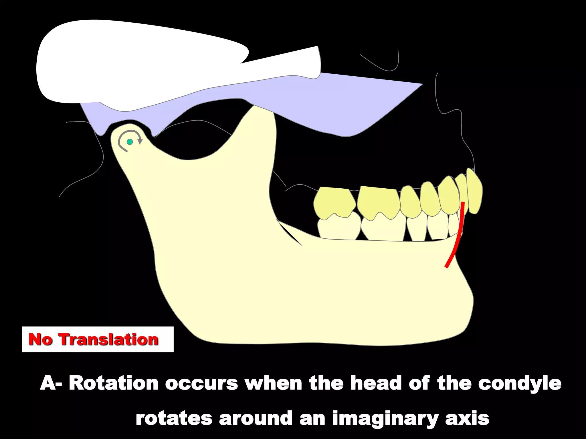 3- Occlusion in prosthodontics- Factors affecting balanced occlusion | PPTX