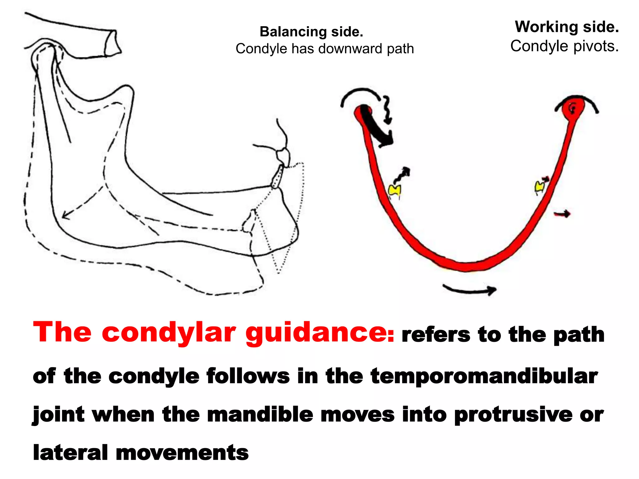 3- Occlusion in prosthodontics- Factors affecting balanced occlusion | PPTX