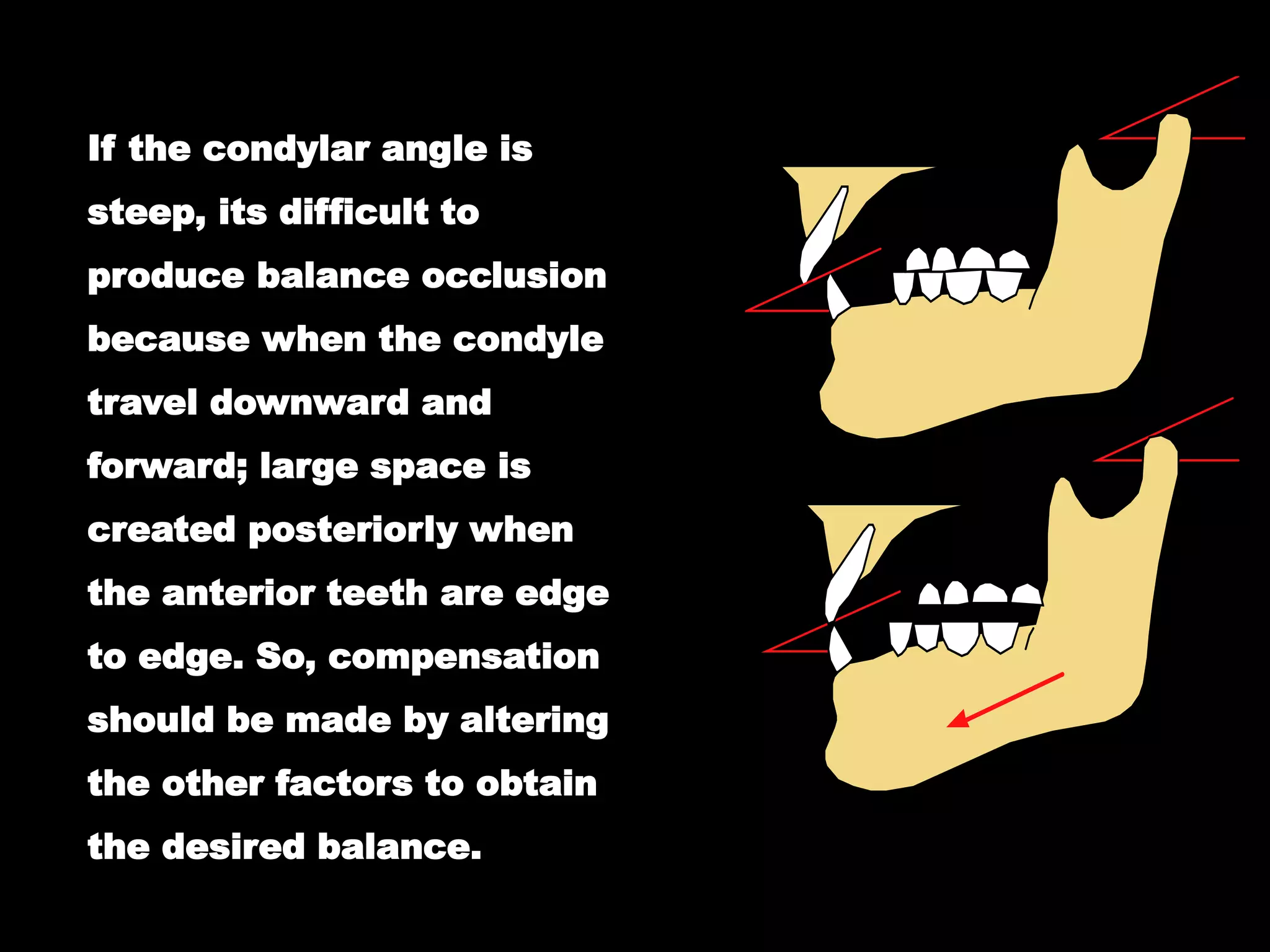 3- Occlusion in prosthodontics- Factors affecting balanced occlusion | PPTX