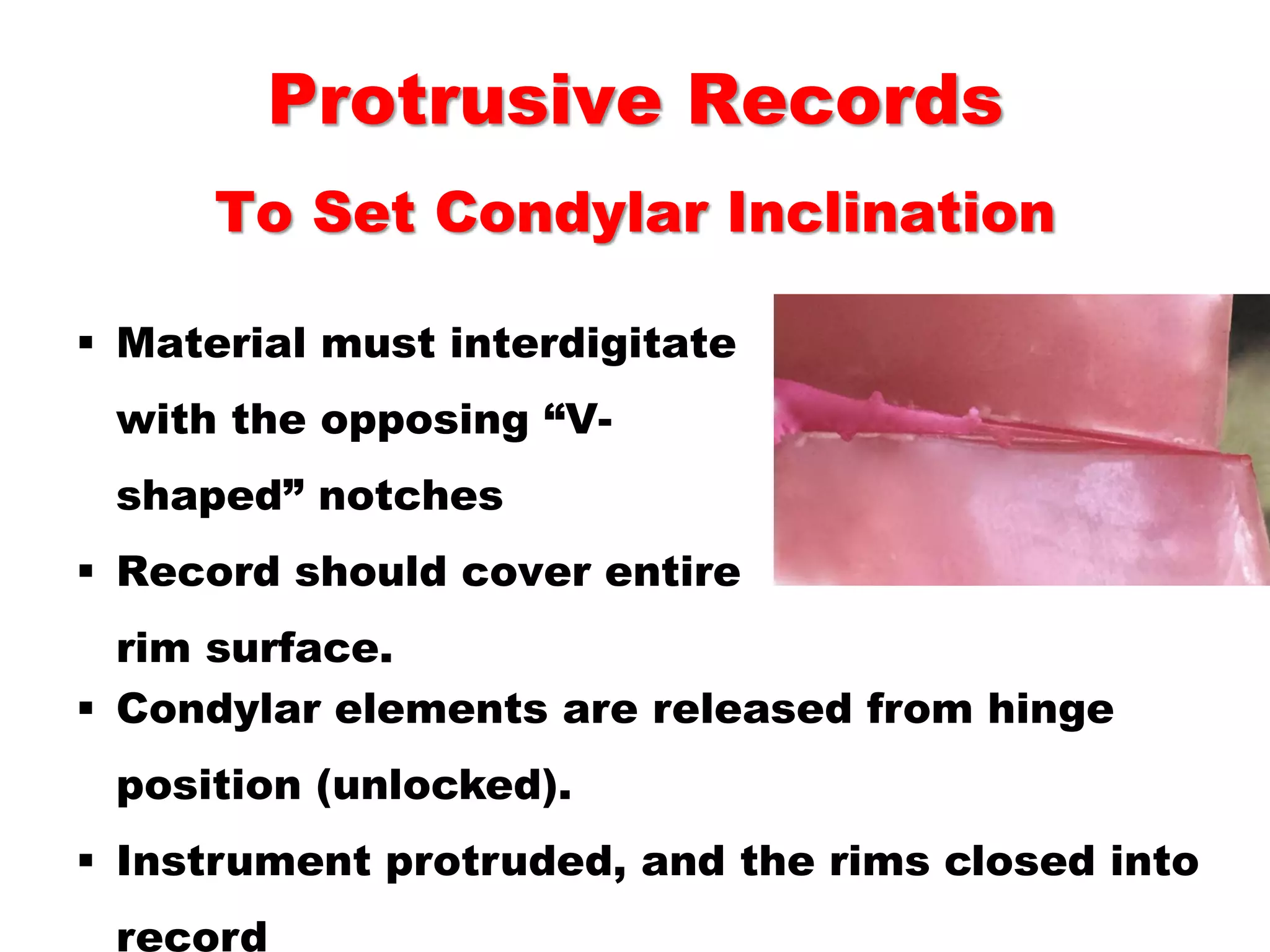 3- Occlusion in prosthodontics- Factors affecting balanced occlusion | PPTX